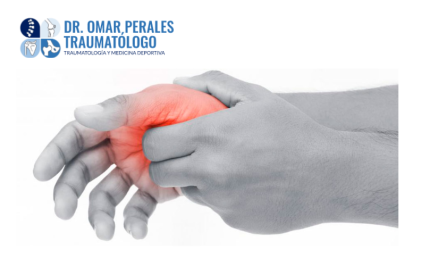 TENOSINOVITIS DE QUERVAIN - Dr. Perales traumatólogo