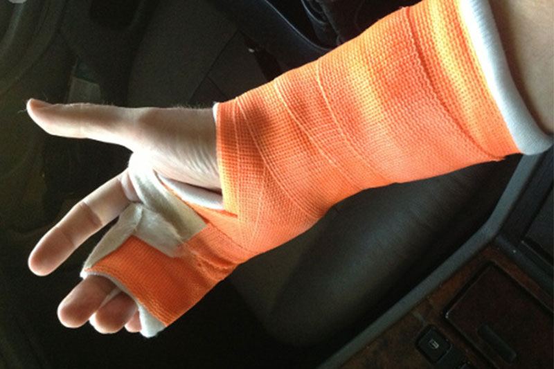 CIRUGÍA DE FRACTURAS – Dr. Omar Perales